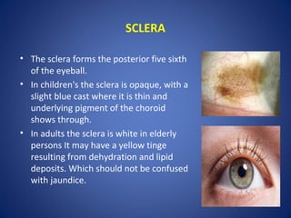 Visual changes in aging | PPT