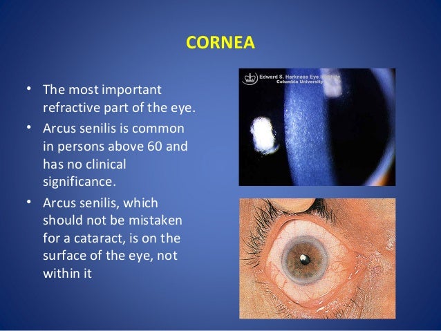 Visual changes in aging