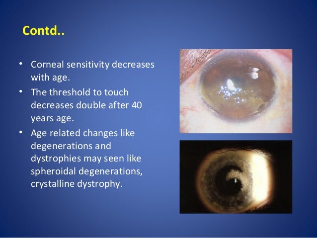 Visual changes in aging