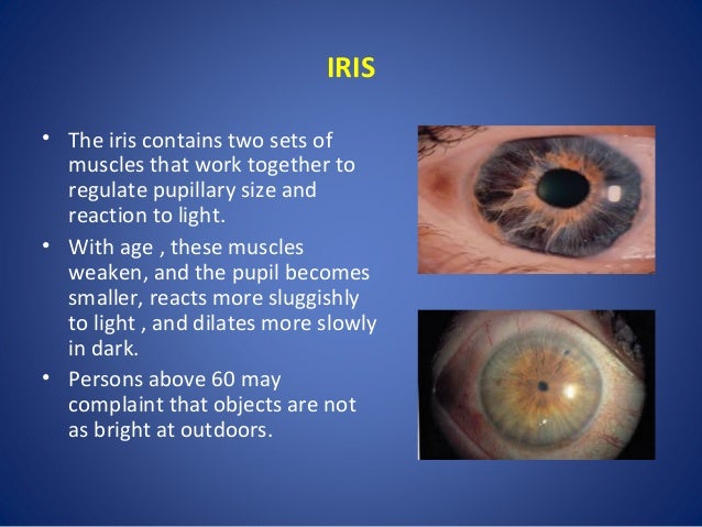 Visual changes in aging