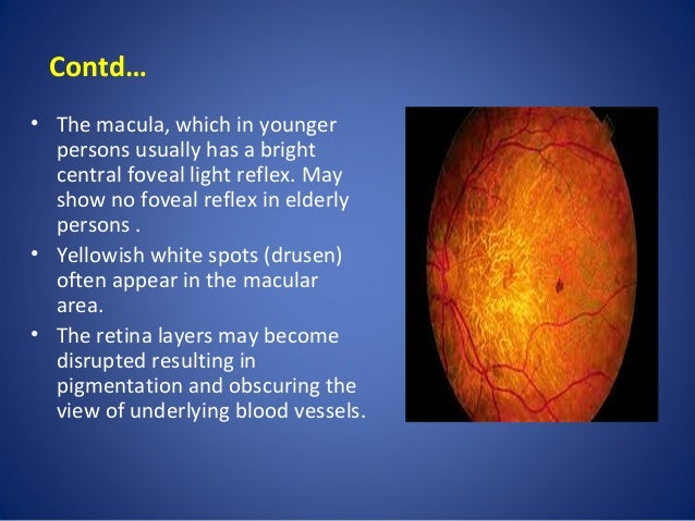 Visual changes in aging