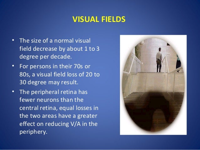 Visual changes in aging