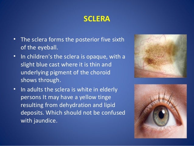Visual changes in aging