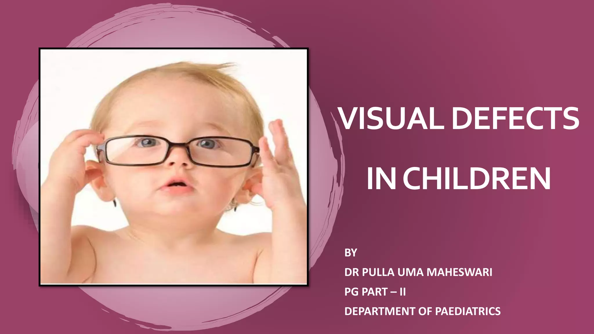 VISUAL DEFECTS IN CHILDREN.pptx