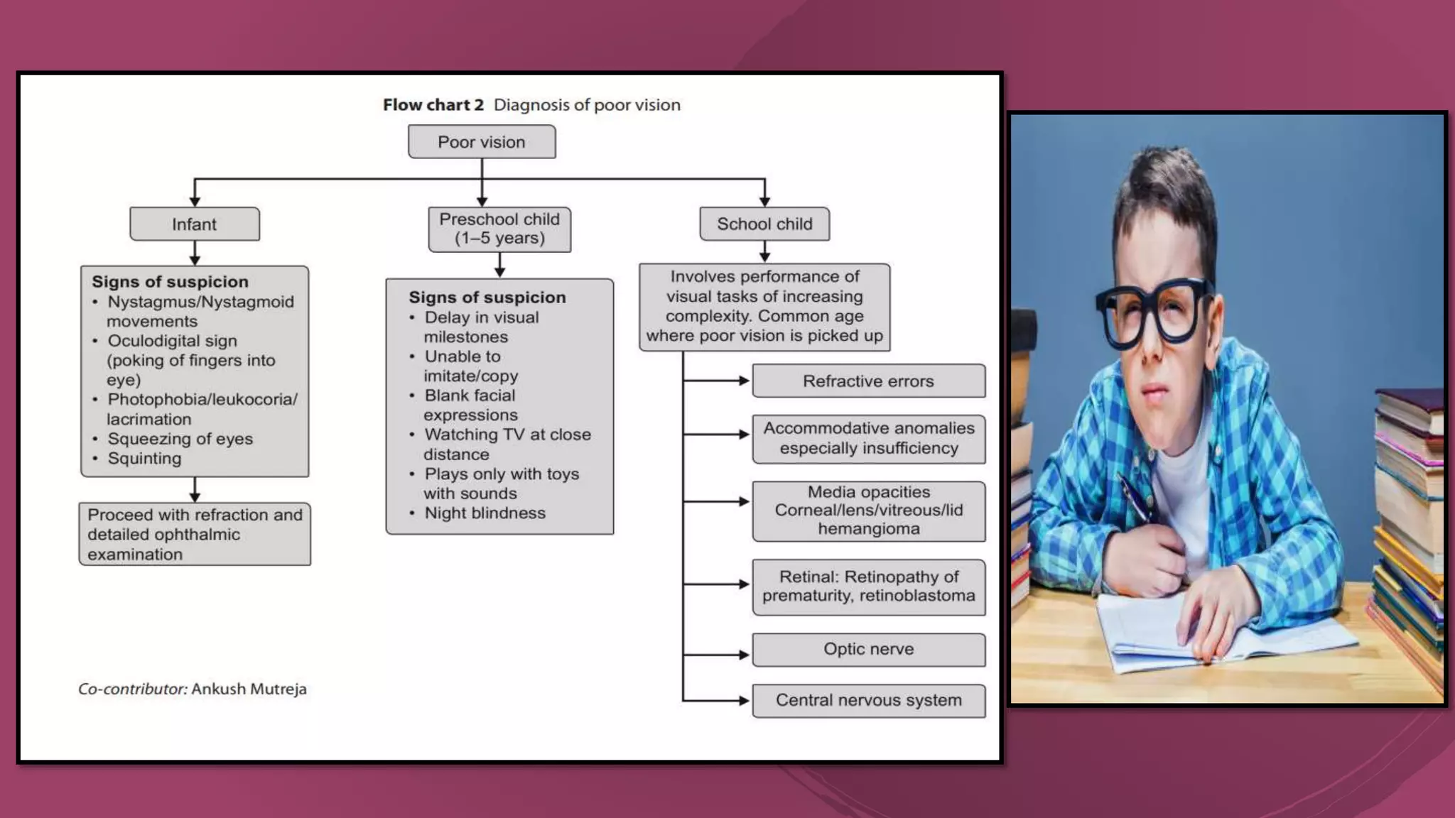 VISUAL DEFECTS IN CHILDREN.pptx