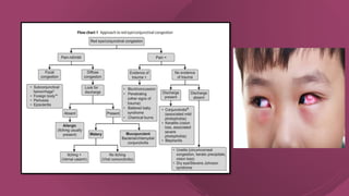 VISUAL DEFECTS IN CHILDREN.pptx