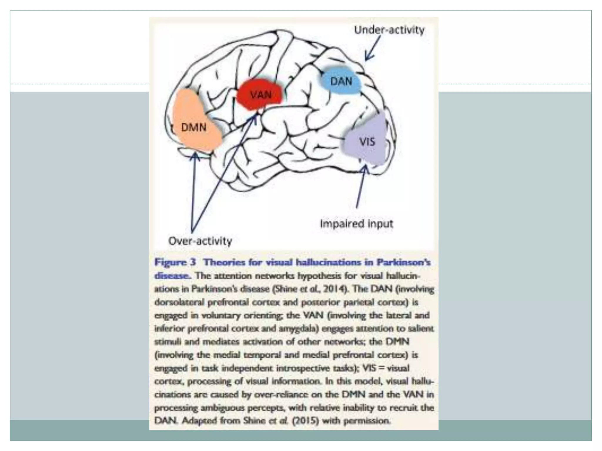 Visual Dysfunction in Parkinson Disease | PPTX
