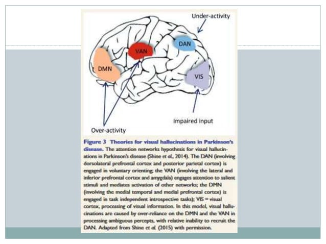 Visual Dysfunction in Parkinson Disease | PPT