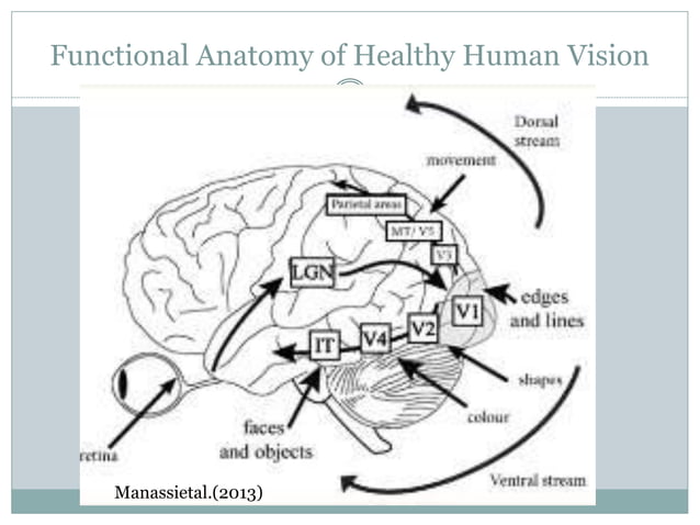 Visual Dysfunction in Parkinson Disease | PPT