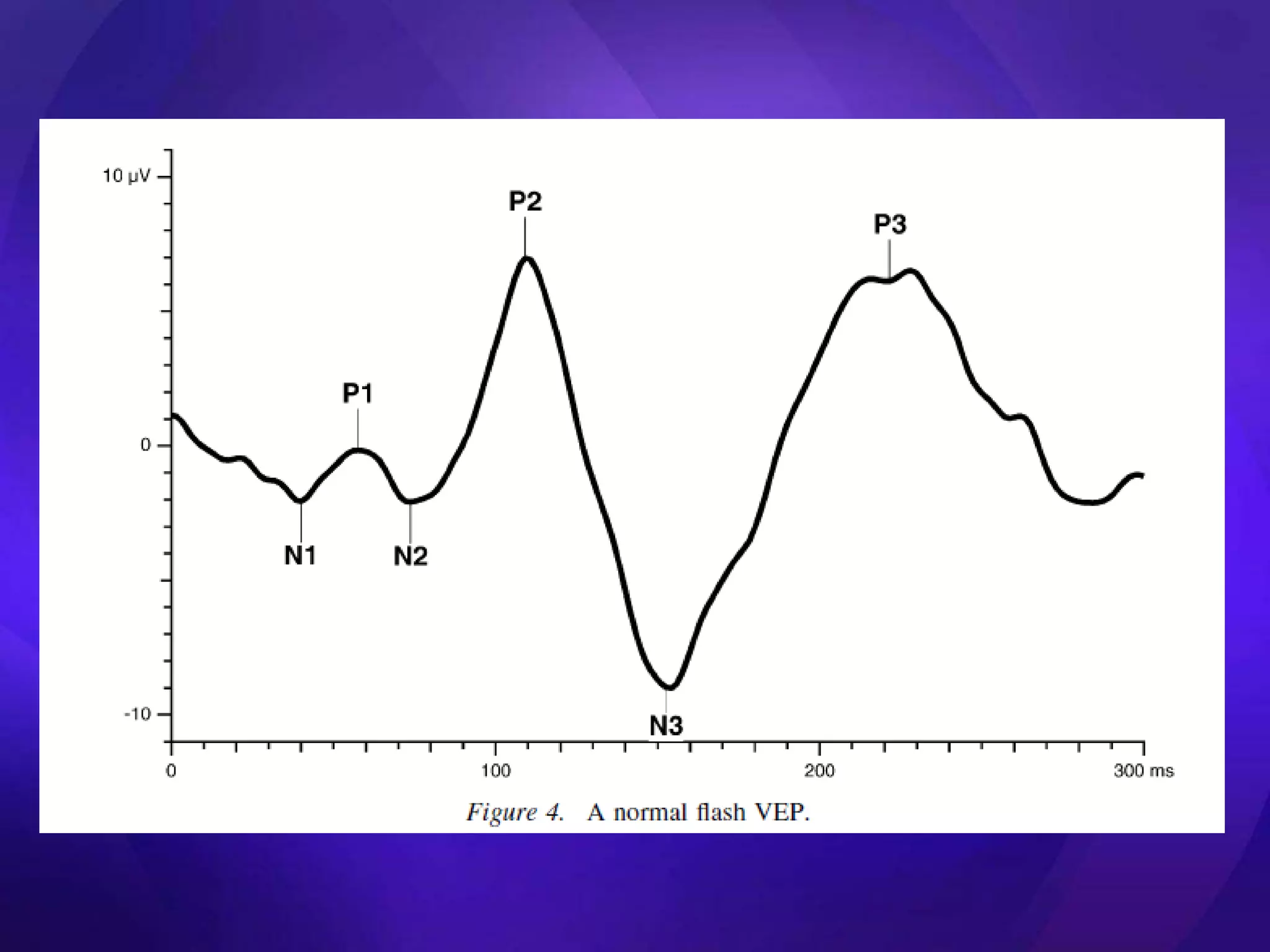 Visual evoked potential | PPTX