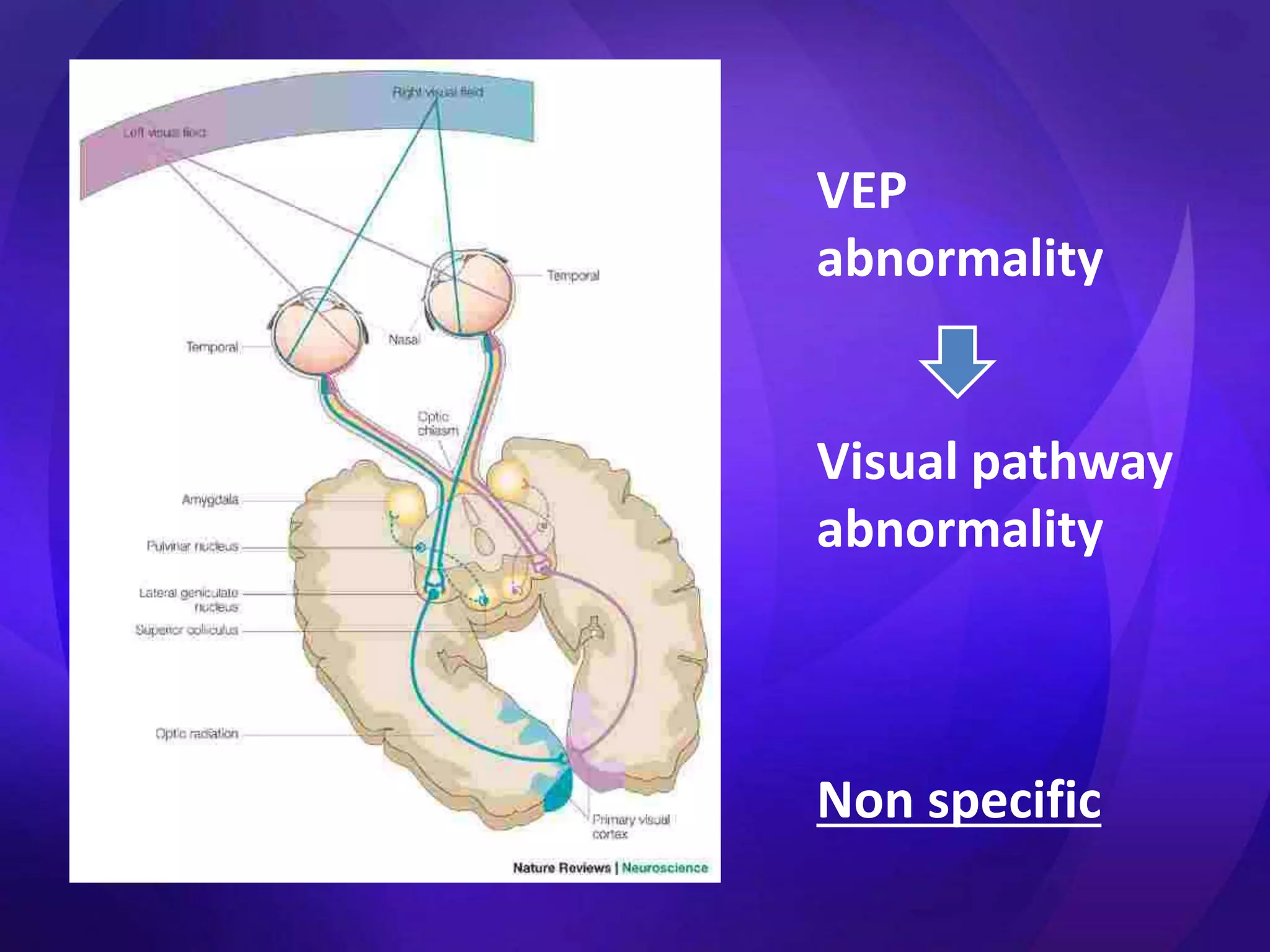 Visual evoked potential | PPTX