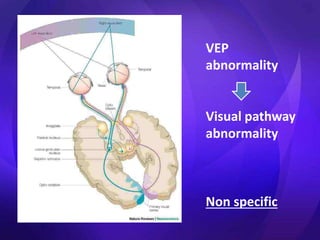 Visual evoked potential | PPTX