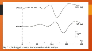 visual evoked potential and its applications.pptx