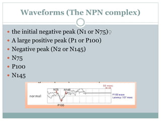 OPTOMETRY VISUAL EVOKED POTENTIAL (1).pptx