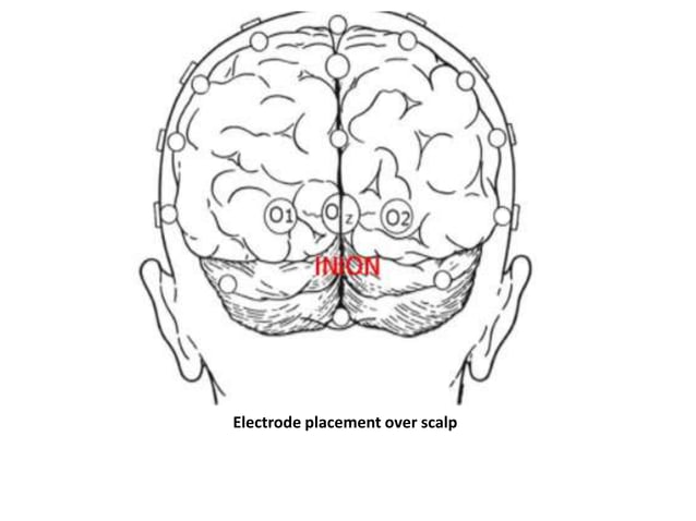 Visual evoked potentials | PPTX