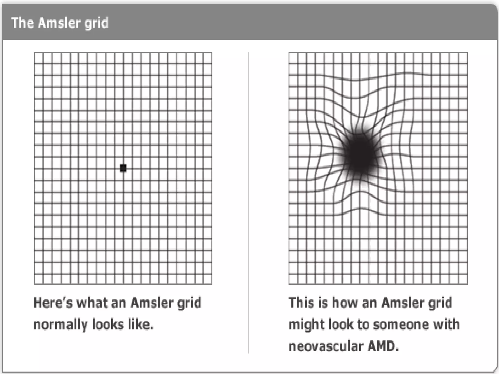 Visual field | PPT