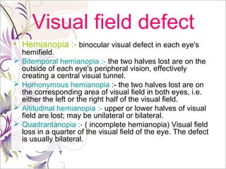 Visual field | PPT