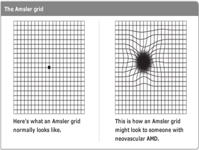 Visual field