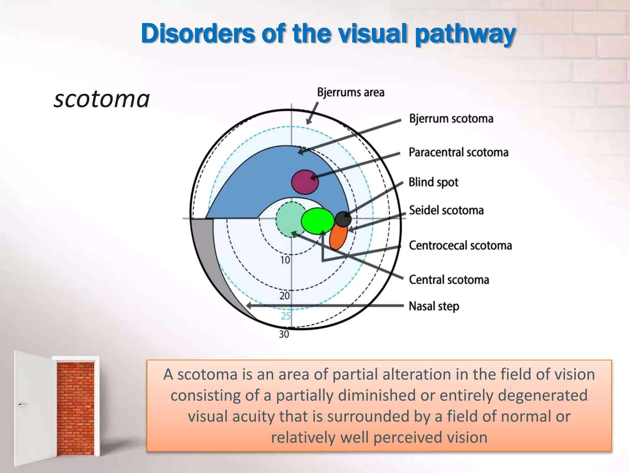 Visual field evaluation | PPT