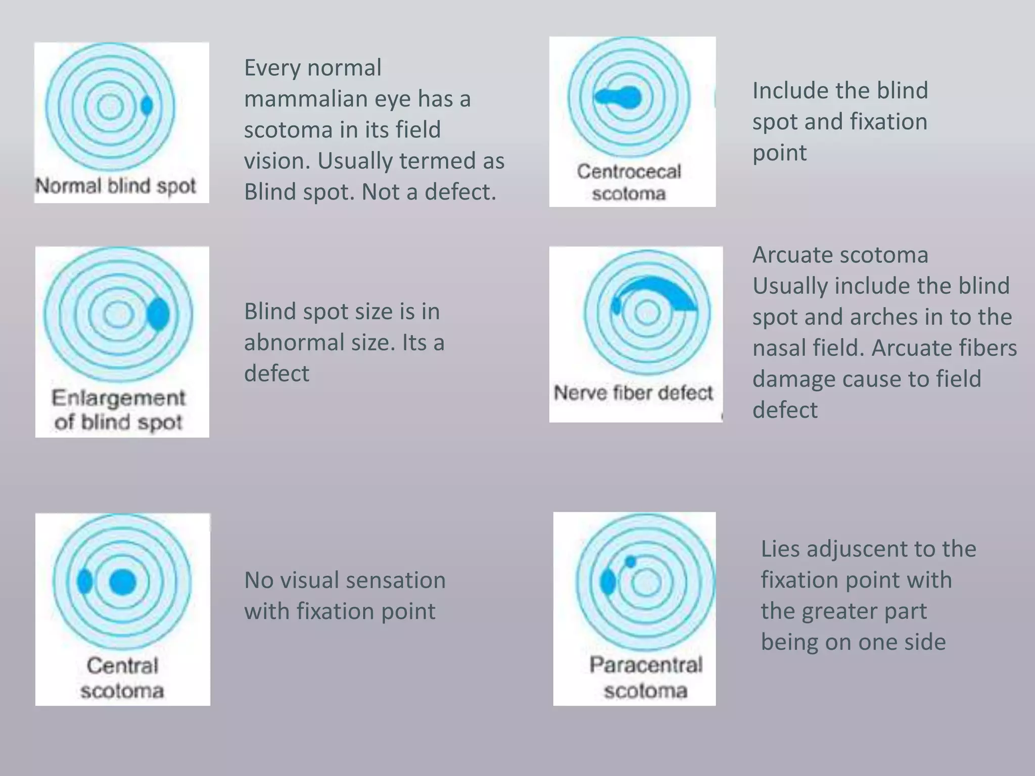 Visual field evaluation | PPT