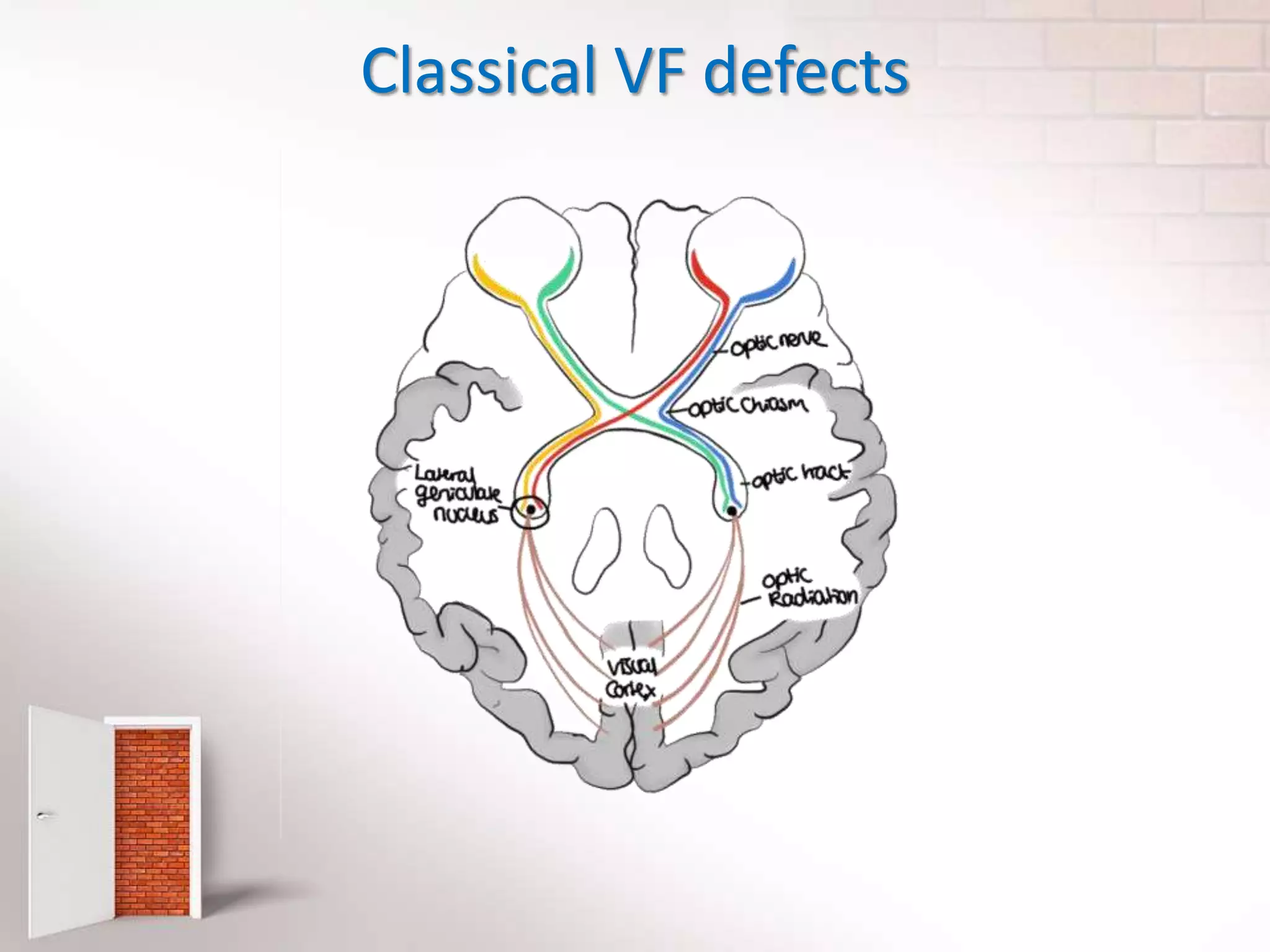 Visual field evaluation | PPT