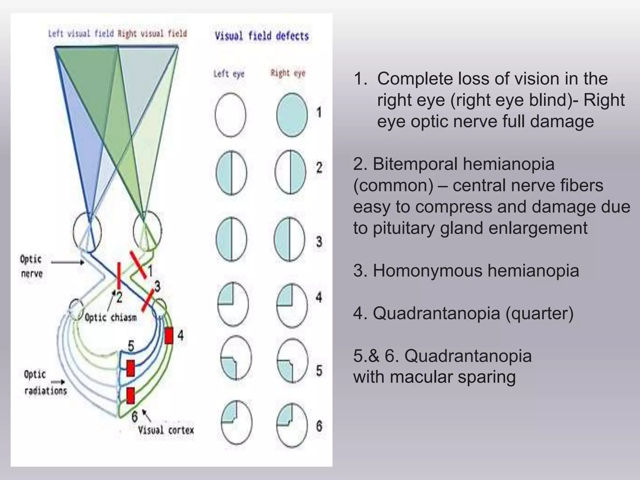 Visual field evaluation | PPTX | Eye and Vision Conditions | Diseases ...