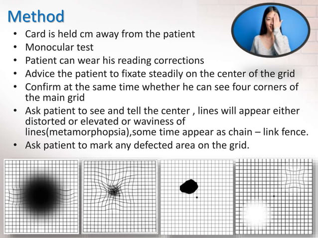 Visual field evaluation | PPTX | Eye and Vision Conditions | Diseases and Conditions