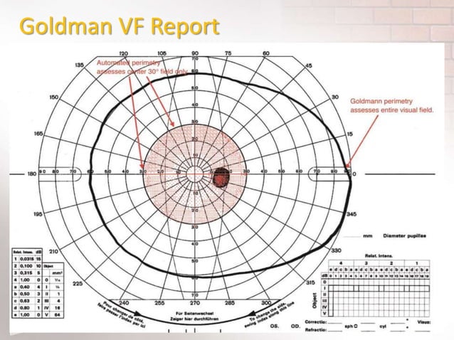 Visual field evaluation | PPTX | Eye and Vision Conditions | Diseases and Conditions