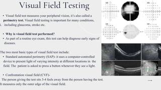 A Visual field Seminar Presentation.pptx