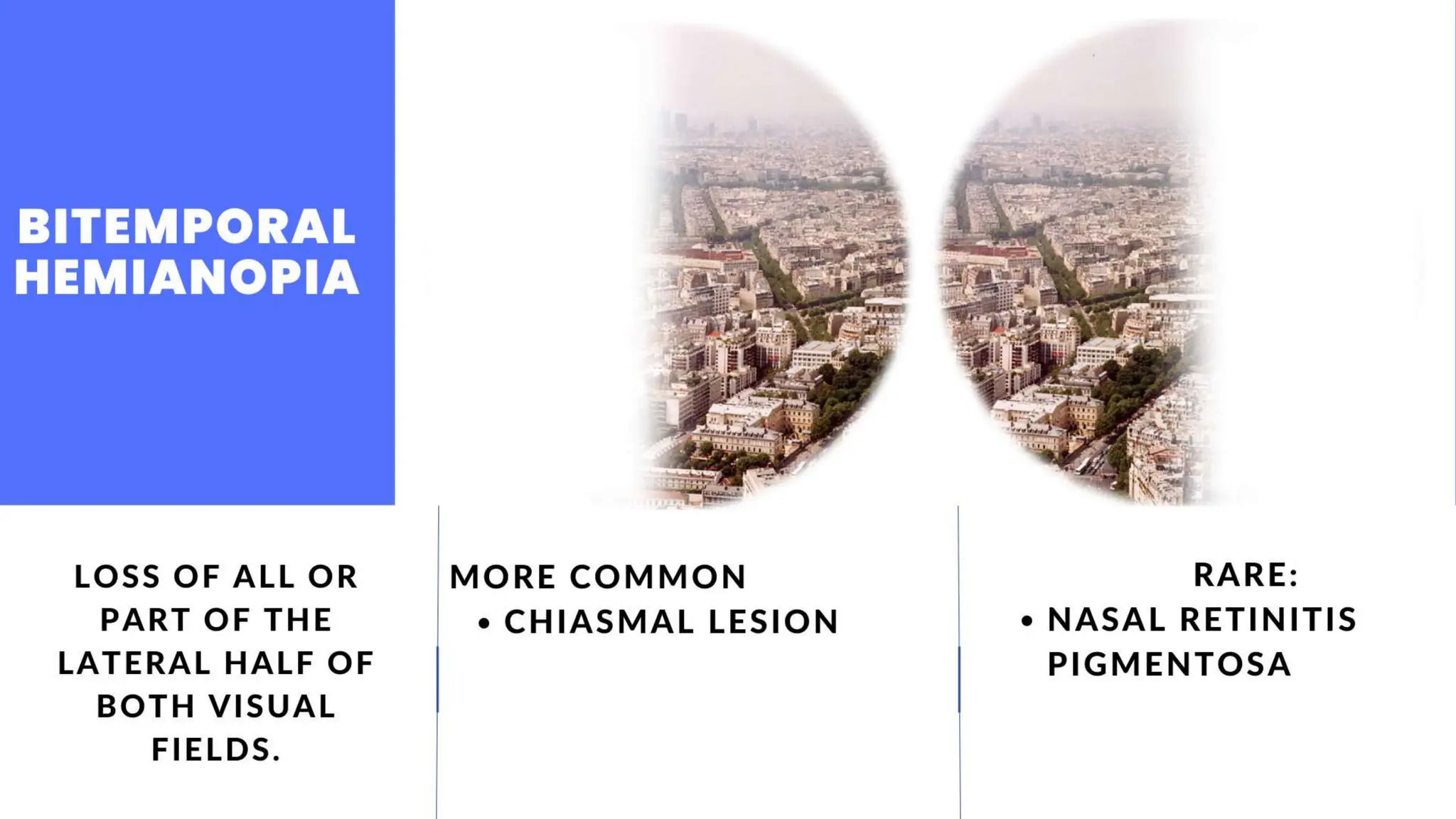 Title: Understanding Visual Field: The Window to Our Visual World.pptx