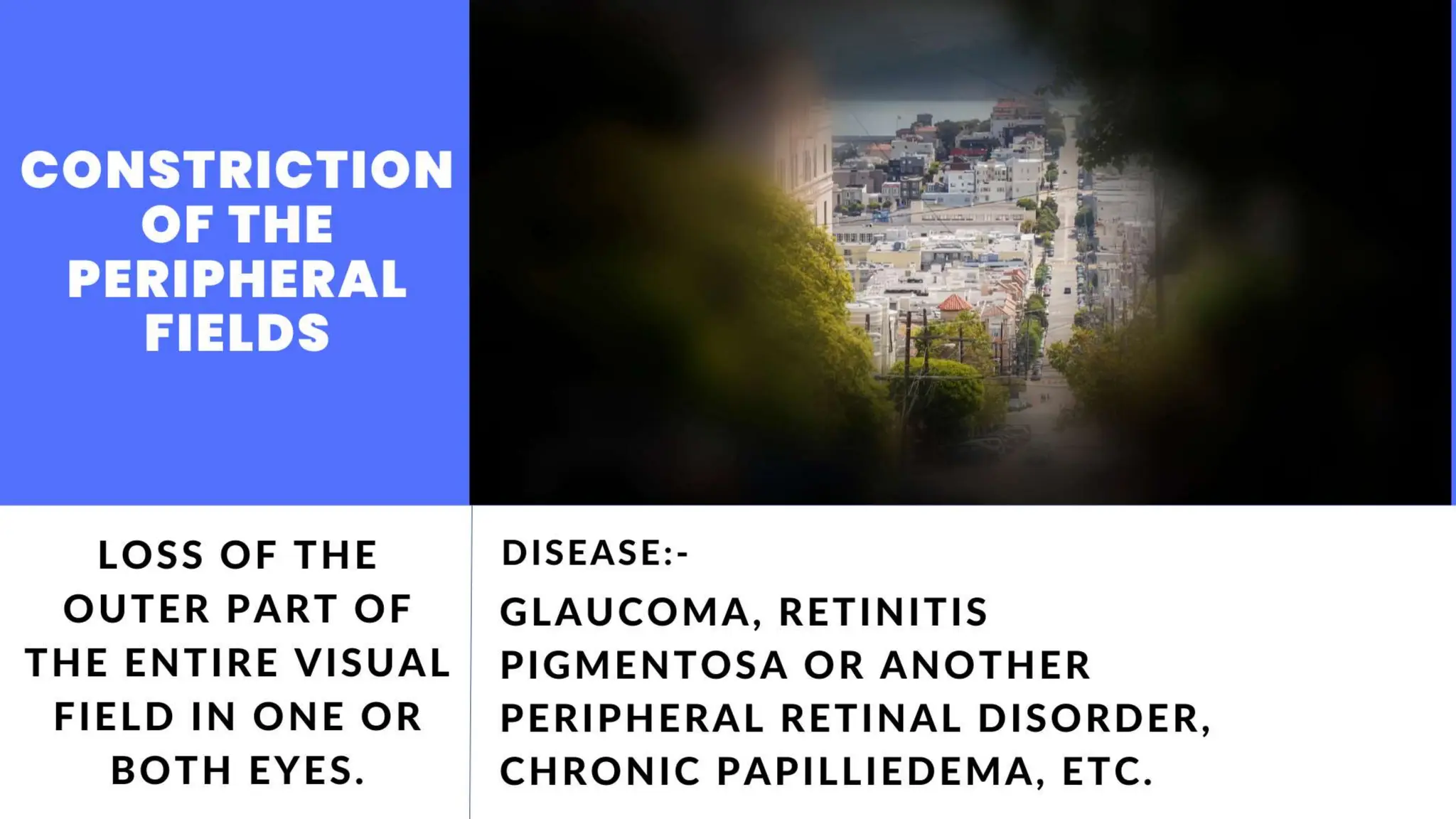 Title: Understanding Visual Field: The Window to Our Visual World.pptx