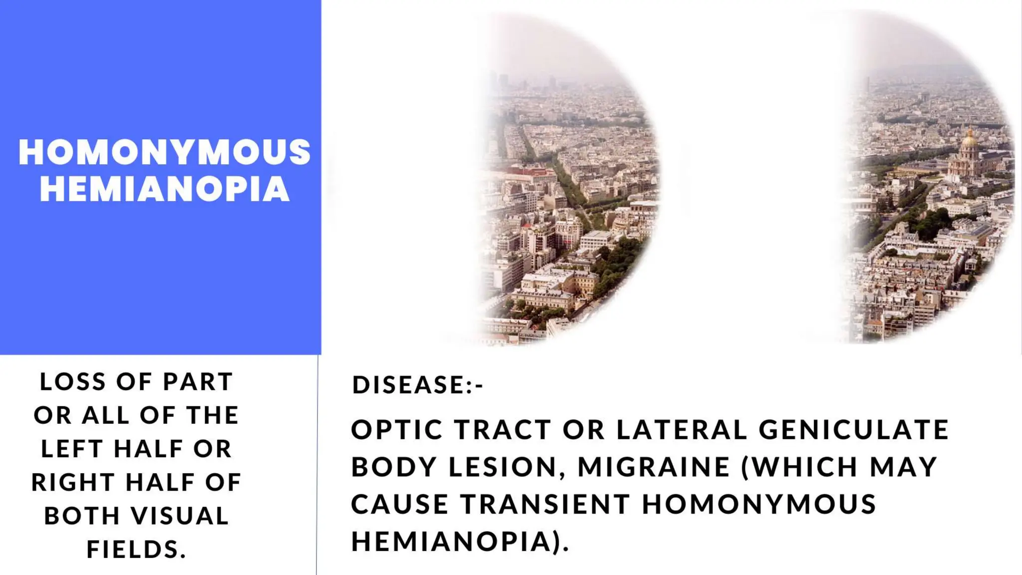 Title: Understanding Visual Field: The Window to Our Visual World.pptx