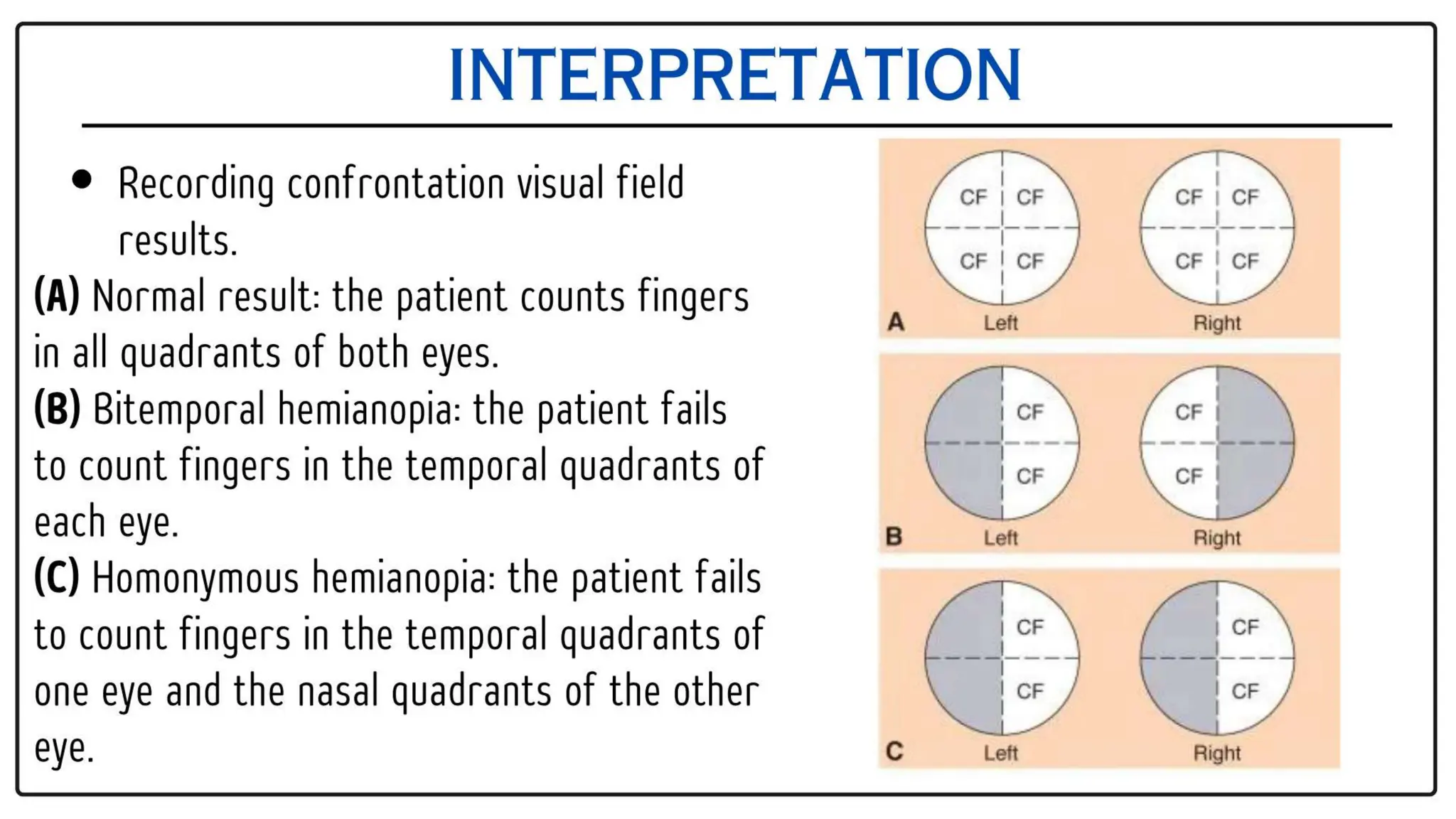 Title: Understanding Visual Field: The Window to Our Visual World.pptx