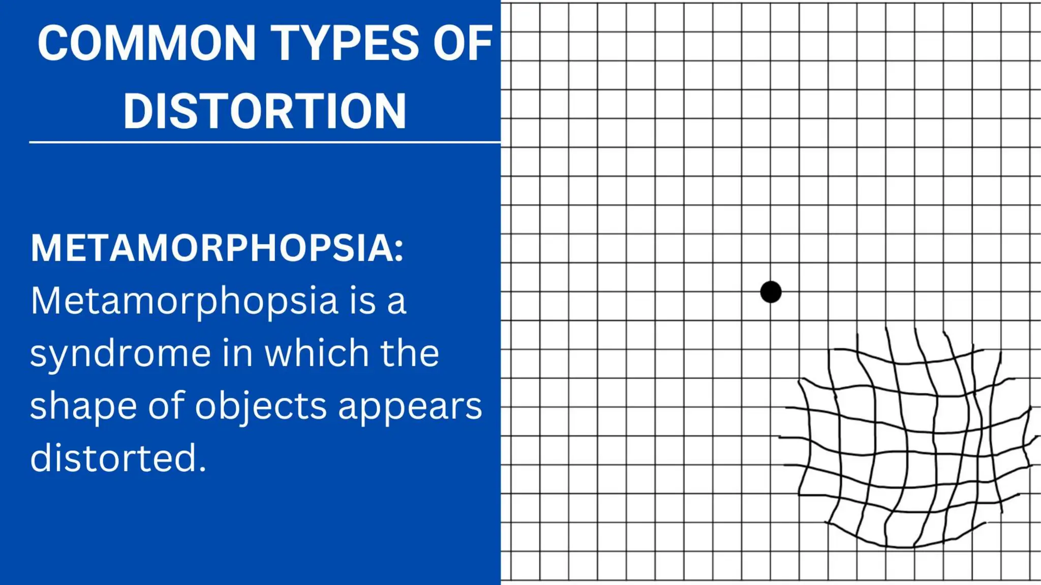 Title: Understanding Visual Field: The Window to Our Visual World.pptx