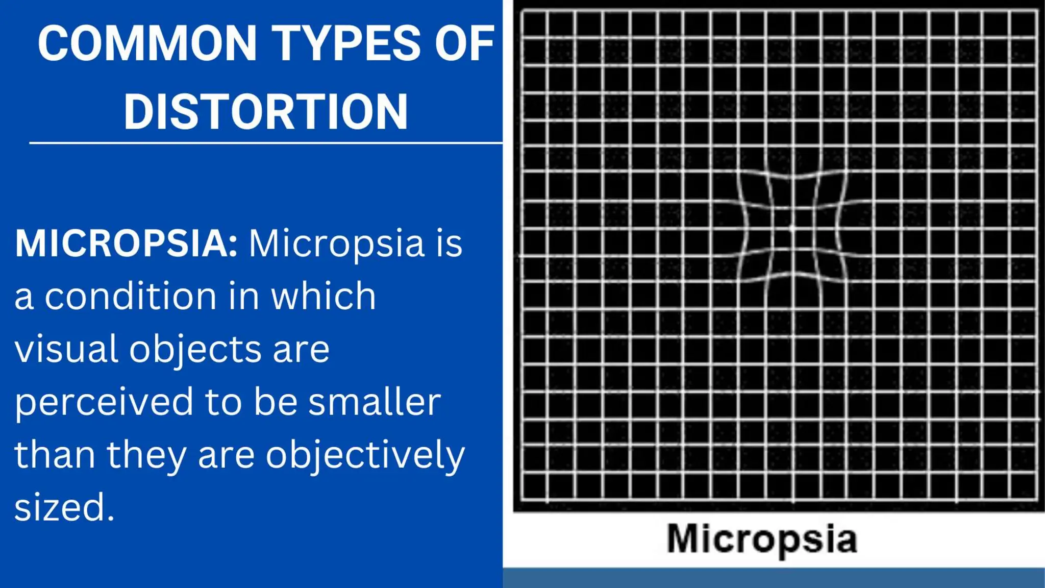 Title: Understanding Visual Field: The Window to Our Visual World.pptx