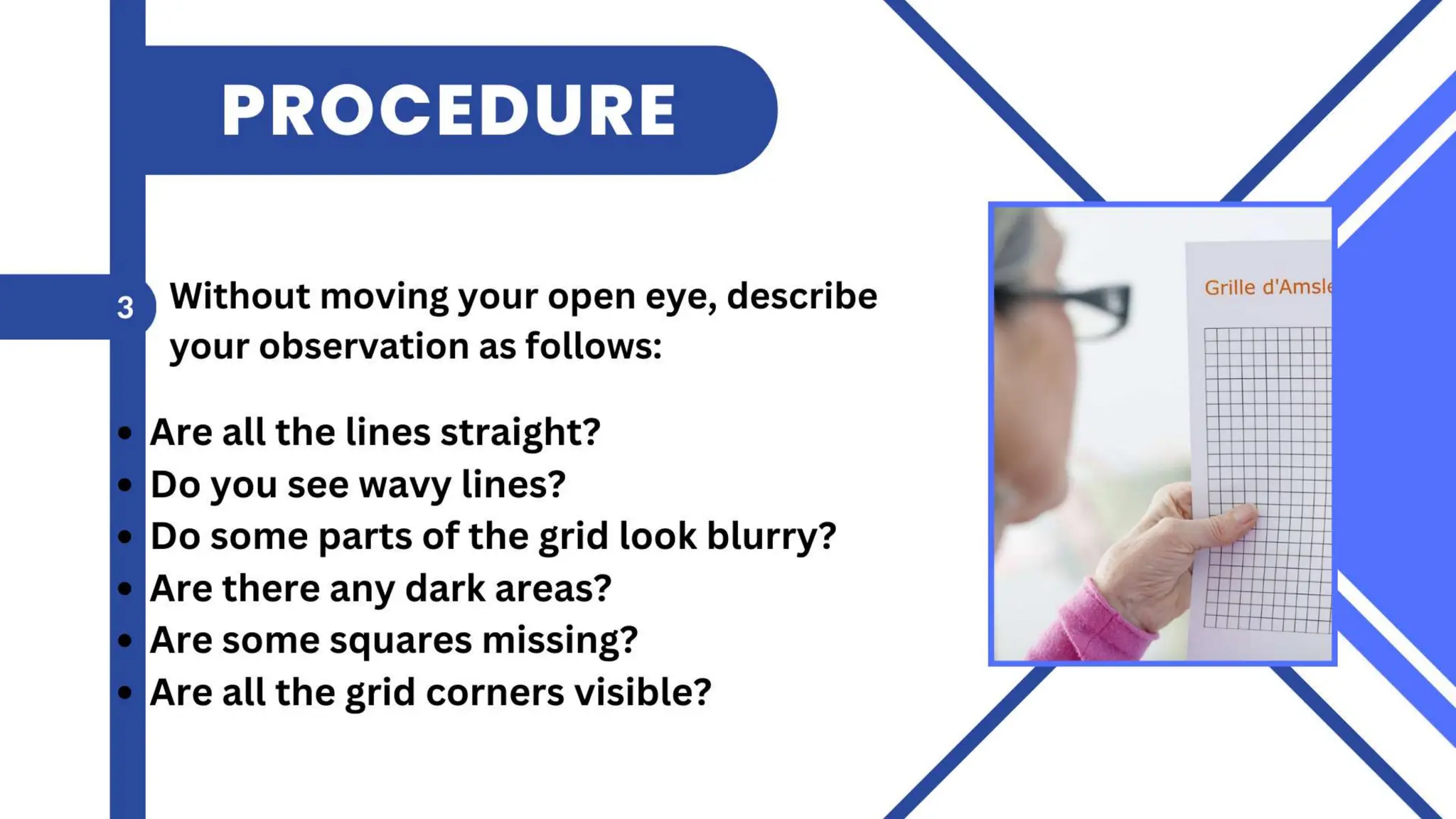 Title: Understanding Visual Field: The Window to Our Visual World.pptx