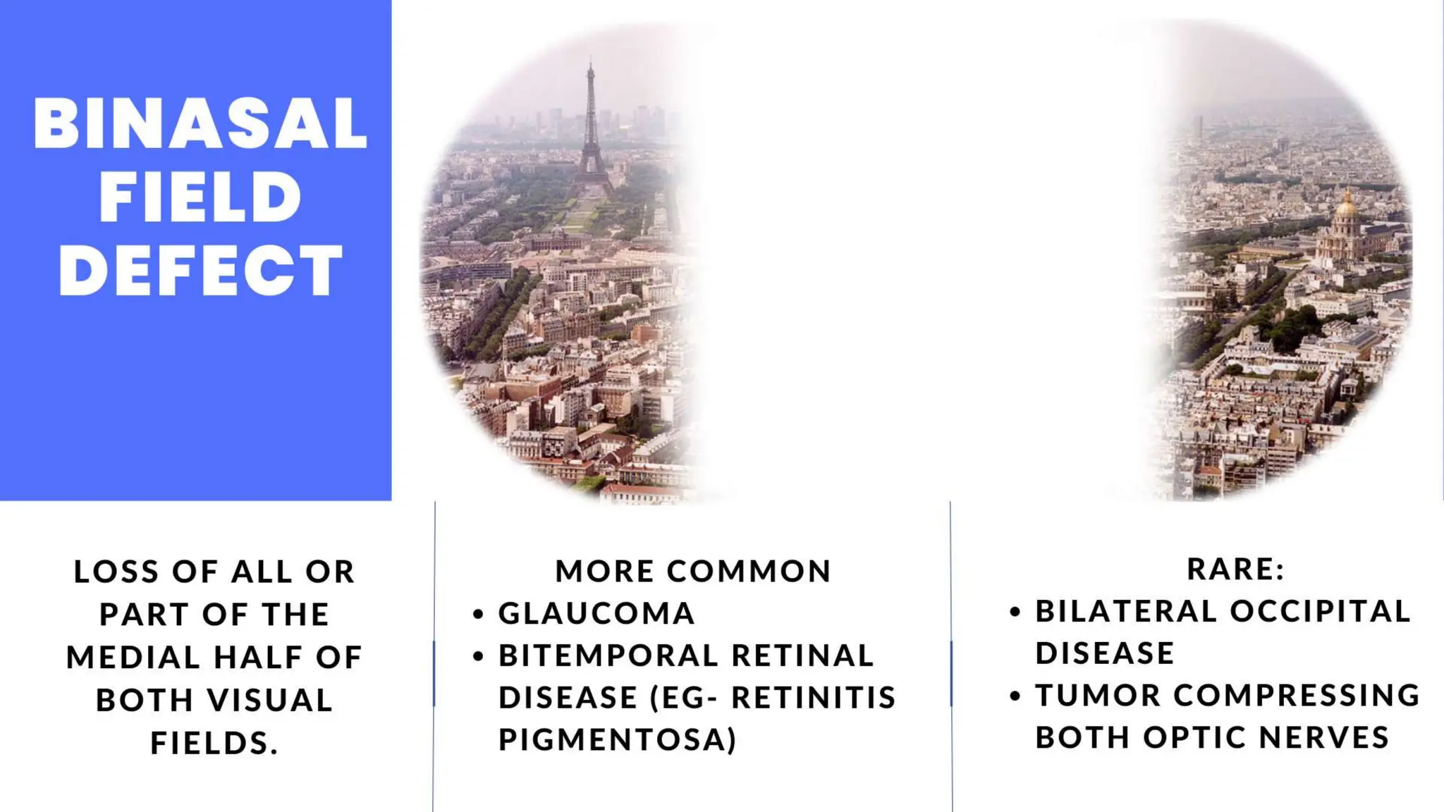 Title: Understanding Visual Field: The Window to Our Visual World.pptx