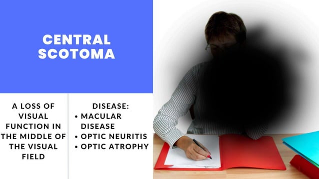 Title: Understanding Visual Field: The Window to Our Visual World.pptx