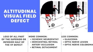 Title: Understanding Visual Field: The Window to Our Visual World.pptx