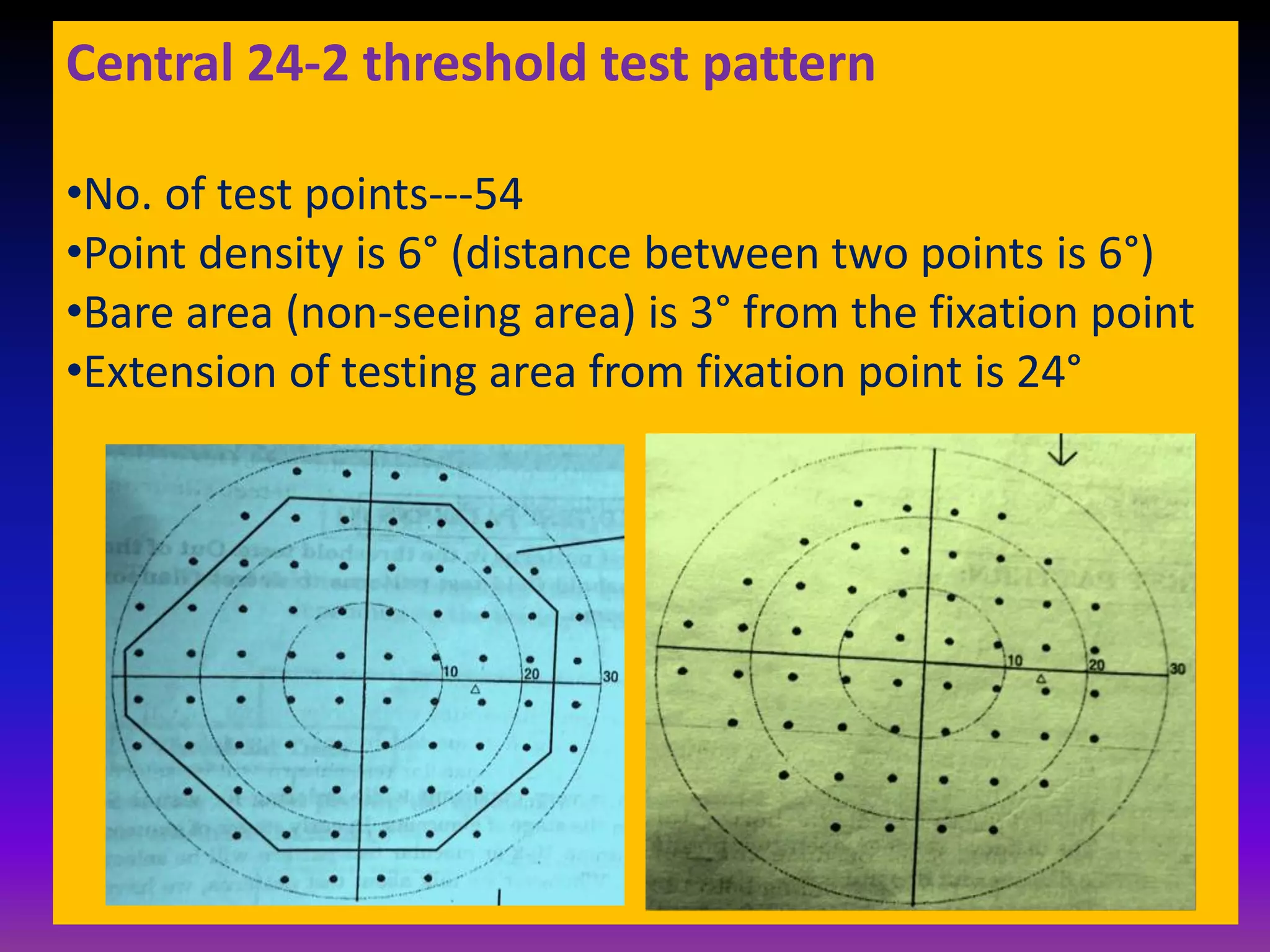 Visual field analysis--interpretation | PPTX
