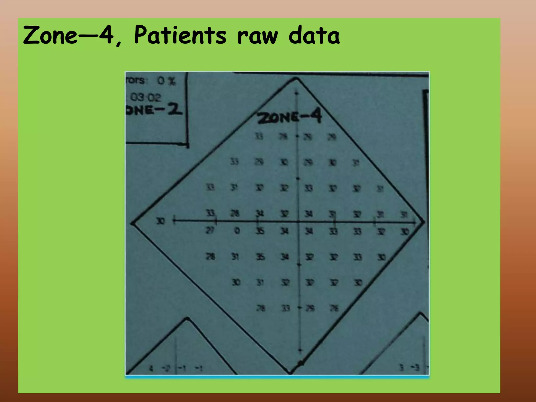 Visual field analysis--interpretation | PPTX