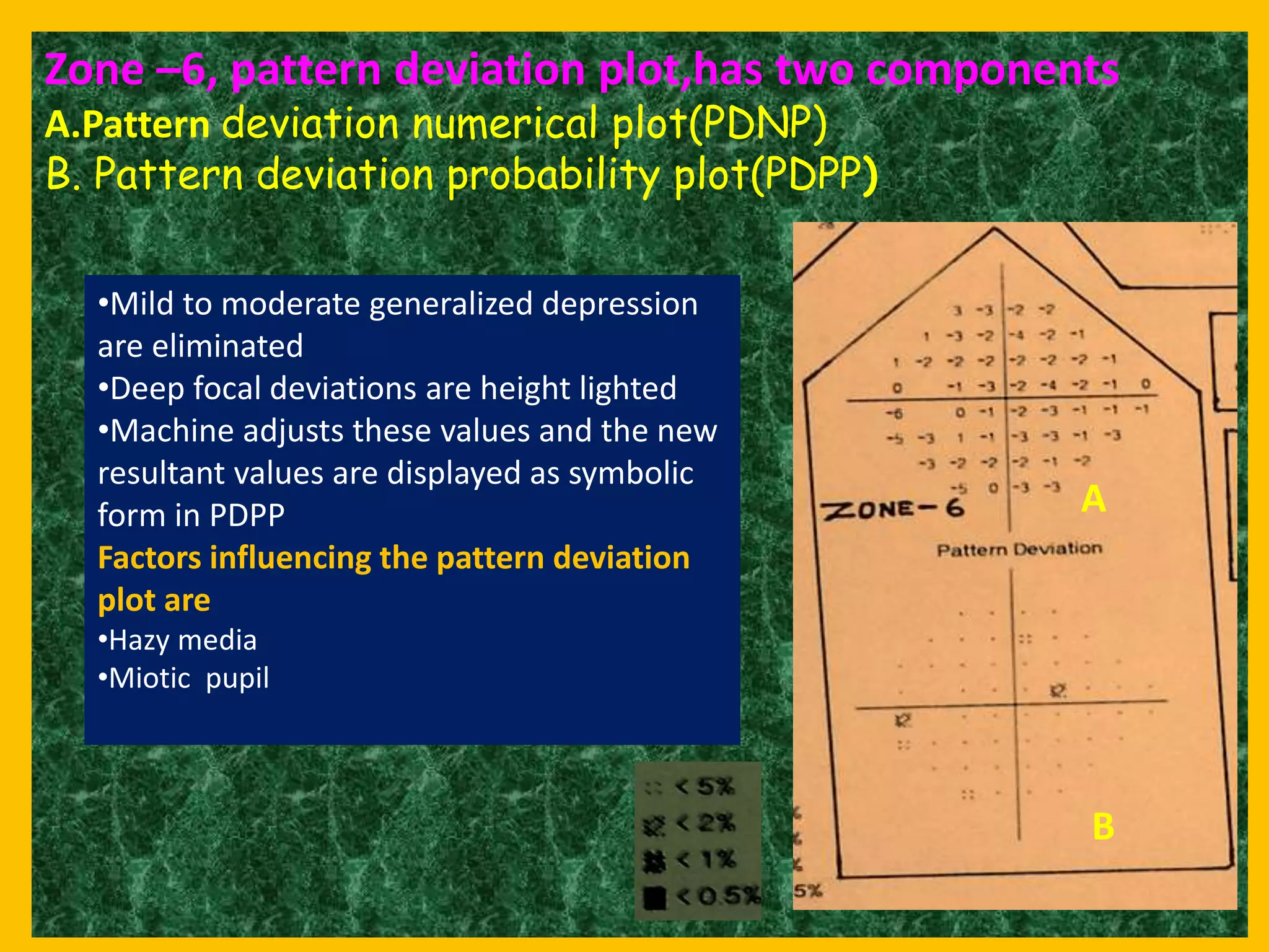 Visual field analysis--interpretation | PPTX