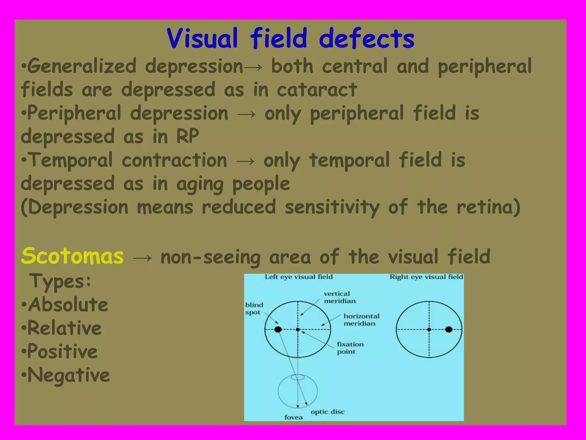 Visual field analysis--interpretation | PPTX