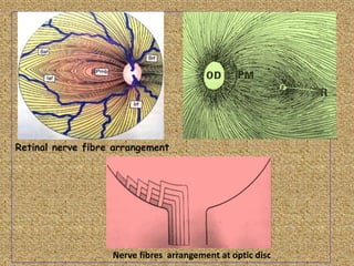 Visual field analysis--interpretation | PPTX