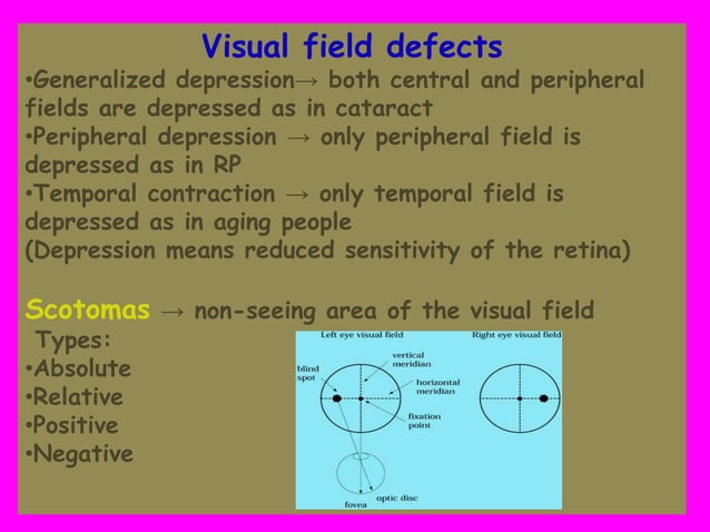 Visual field analysis--interpretation | PPTX | Eye and Vision ...