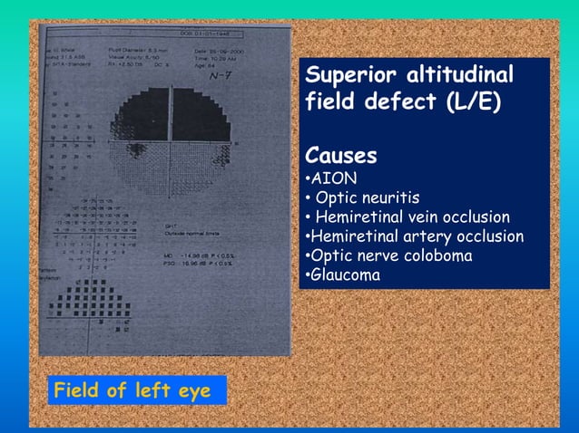 Visual field analysis--interpretation | PPTX | Eye and Vision ...