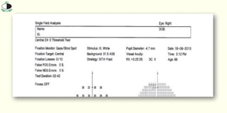 Visual_Field_and_Visual_field_Screening-1.pptx