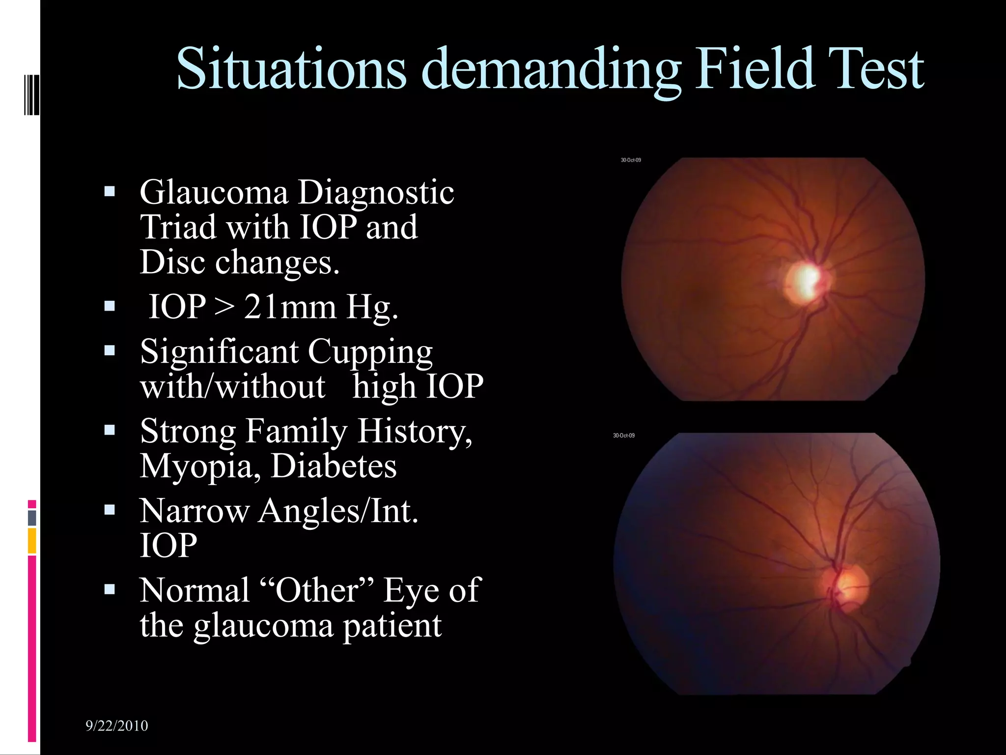 Visual field assessment | PDF