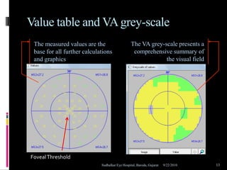 Visual field assessment | PDF