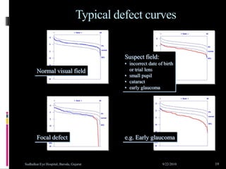 Visual field assessment | PDF